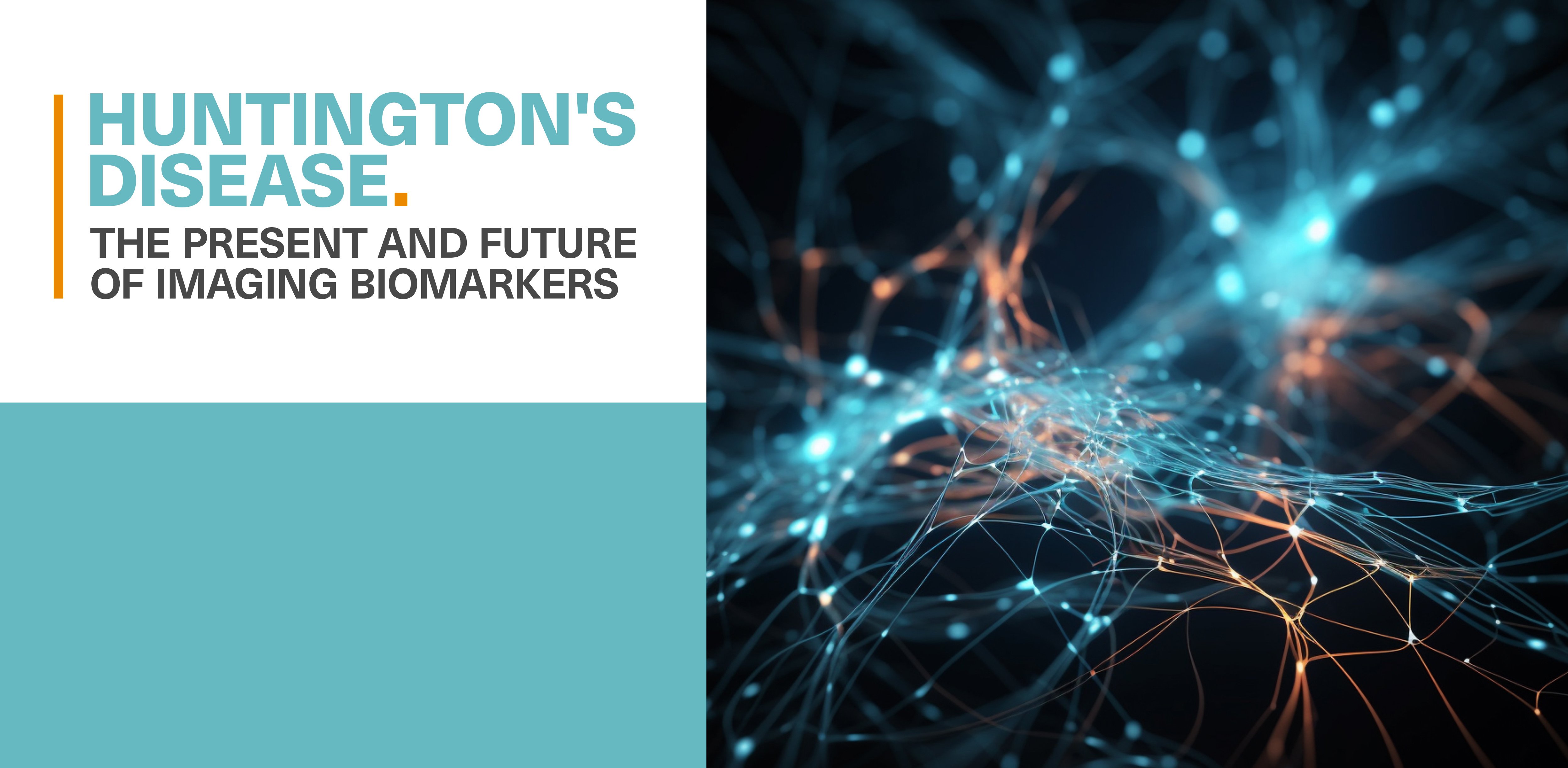 Huntington's Disease: The present and future of imaging biomarkers » IXICO