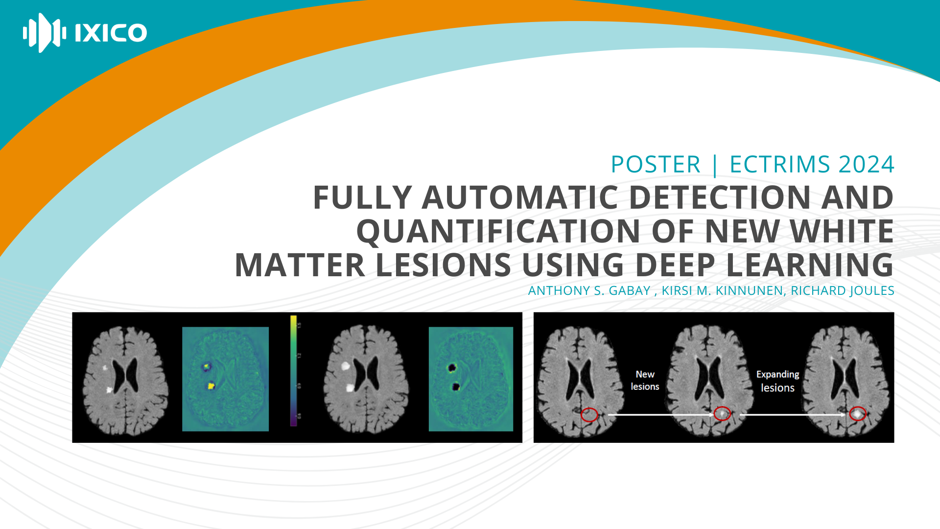 Fully automatic detection and quantification of new white matter lesions using deep learning » IXICO